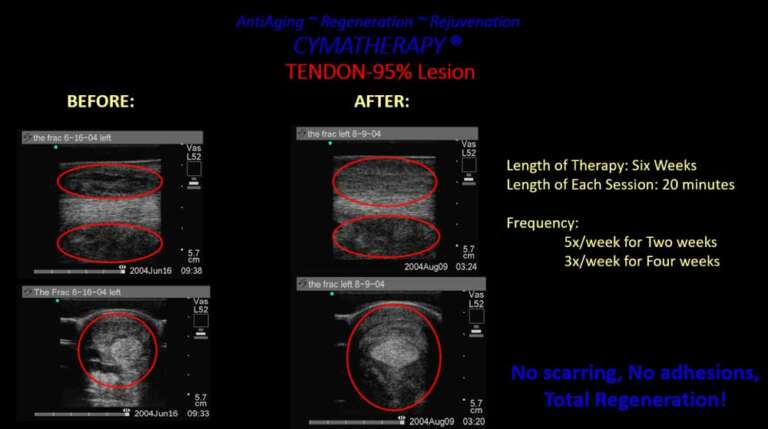 Cymatherapy: Restoring the Core Resonant Frequency to Heal Body Organs ...